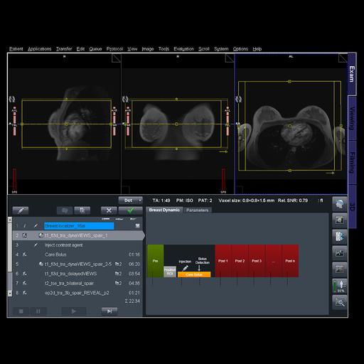 Breast Dot Engine - Siemens Healthineers USA