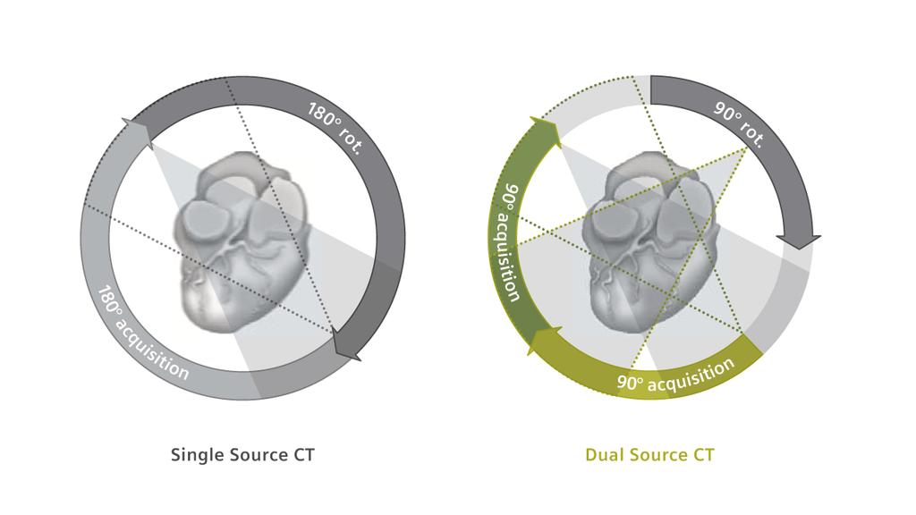SOMATOM Definition Flash - CT Scanner - Siemens Healthineers Vietnam