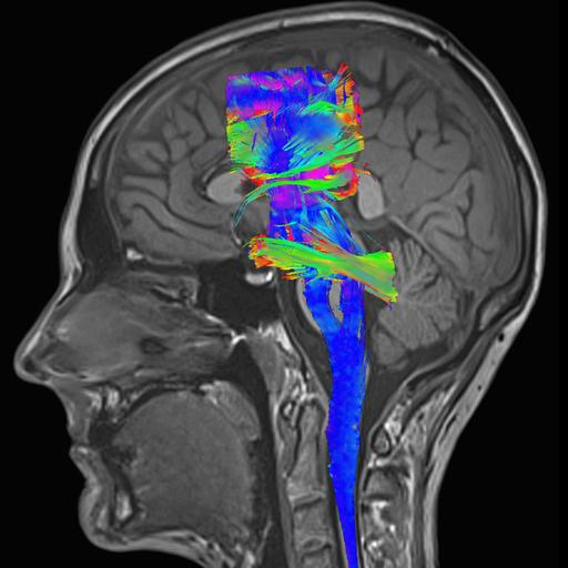 ZOOMit powered by TimTX TrueShape - Siemens Healthineers