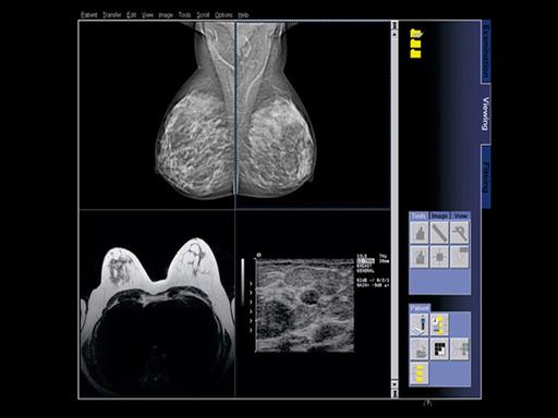 Diagnostics - Siemens Healthineers USA