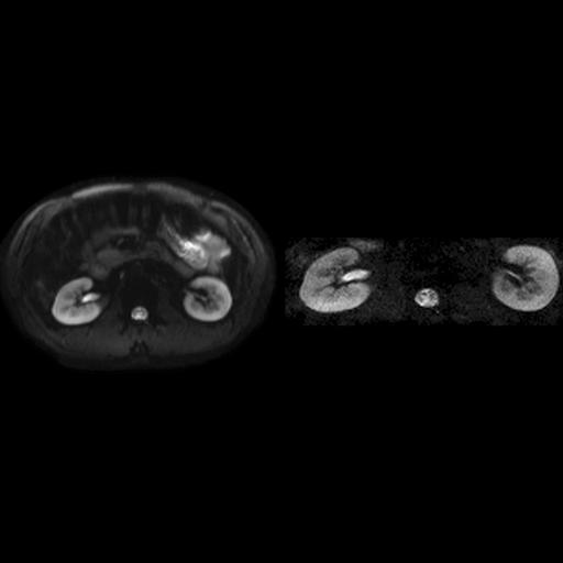 ZOOMit powered by TimTX TrueShape - Siemens Healthineers