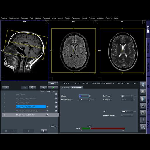 Brain Dot Engine - Siemens Healthineers USA