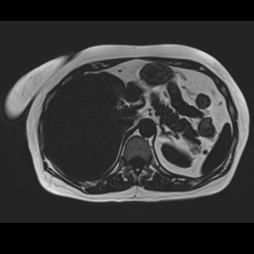 Growth with Body MRI - Siemens Healthineers USA