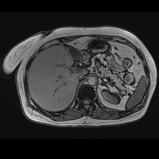 Growth with Body MRI - Siemens Healthineers USA