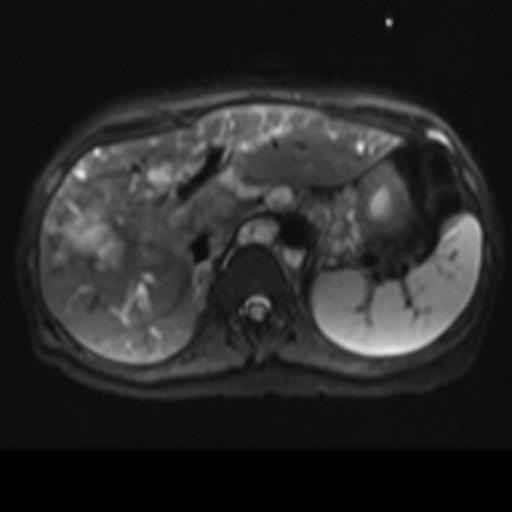 Growth with Body MRI - Siemens Healthineers USA