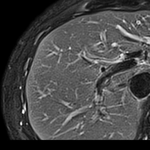 Growth with Body MRI - Siemens Healthineers USA