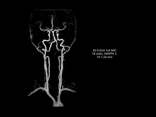 Head/Neck 64 - Siemens Healthineers USA