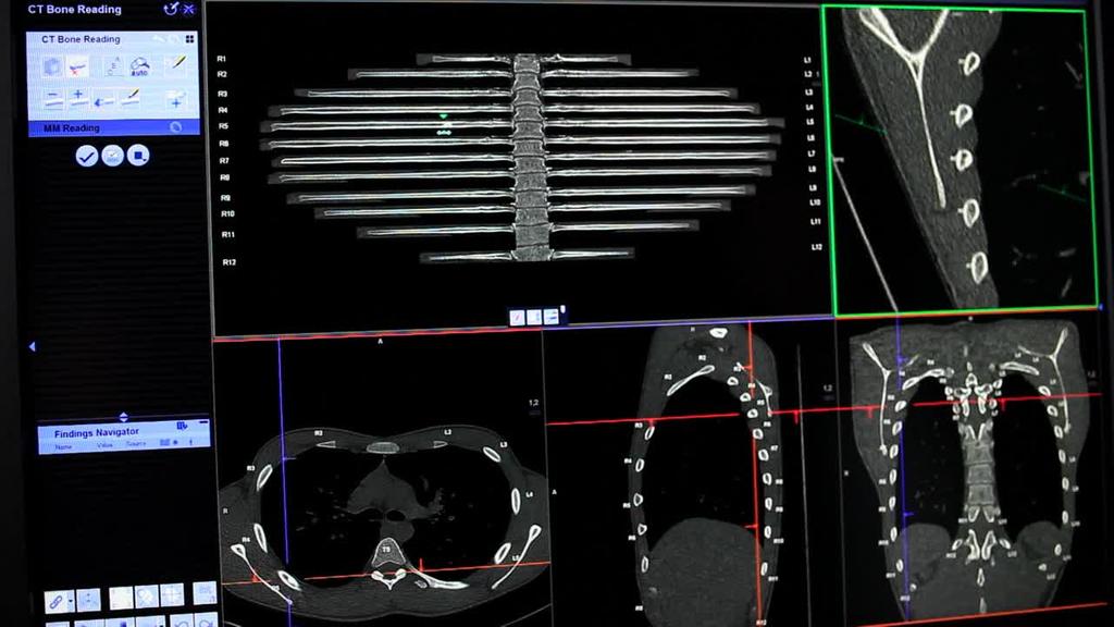 syngo.via - Siemens Healthineers Suisse