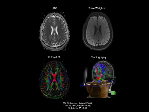 Head/Neck 64 - Siemens Healthineers