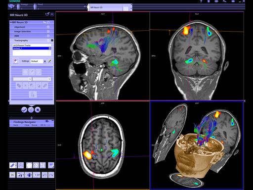 syngo.MR Tractography - Siemens Healthineers USA