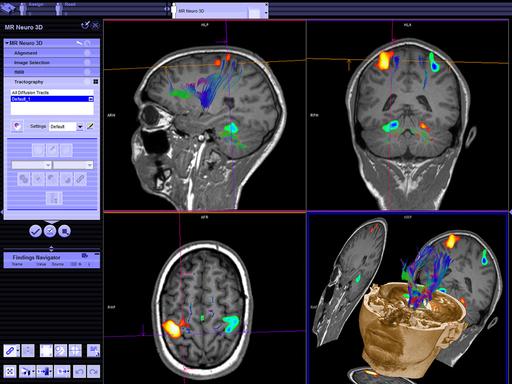 syngo.MR Neuro 3D Engine - Siemens Healthineers USA