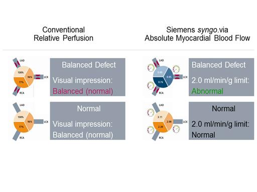 syngo.via - Siemens Healthineers USA