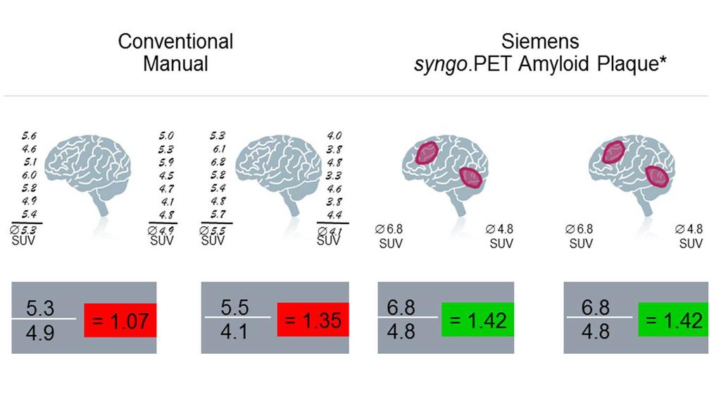 syngo.via - Siemens Healthineers USA