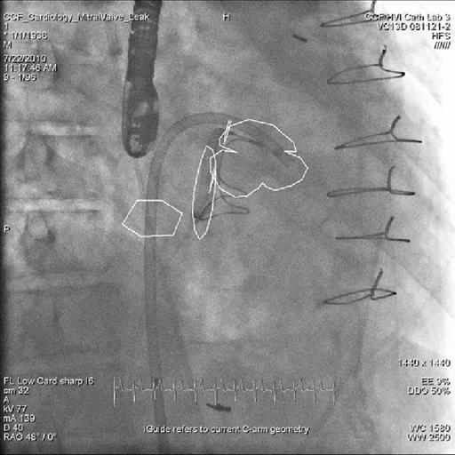 Artis zee - Siemens Healthineers USA