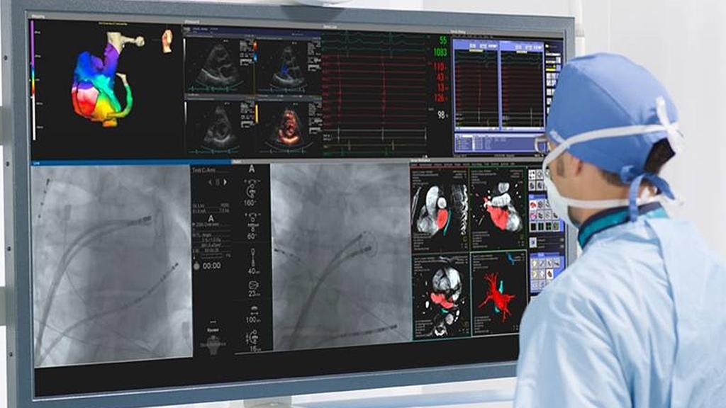 Artis zee - Siemens Healthineers USA