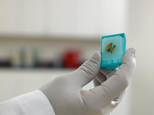 Tissue Preparation System