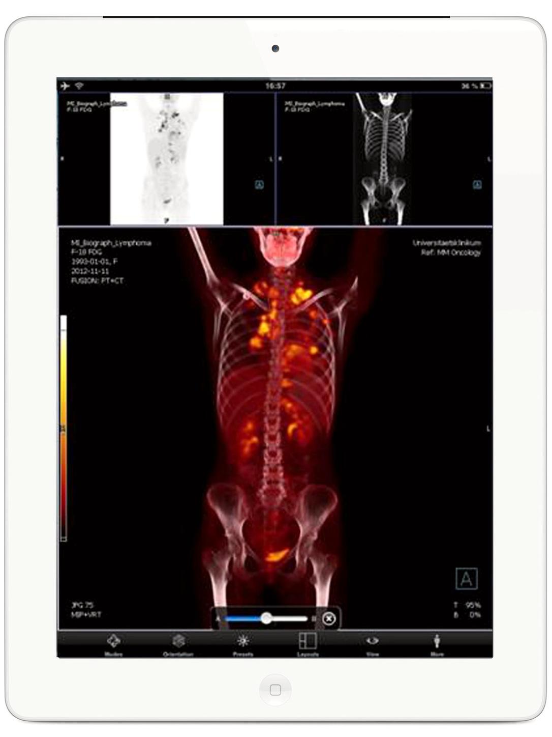 syngo.via - Siemens Healthineers USA