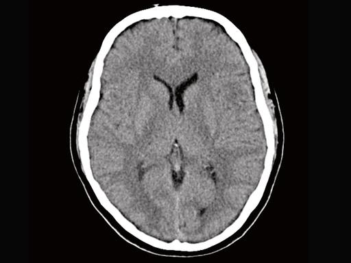 CT Neuro Engine - Siemens Healthineers USA