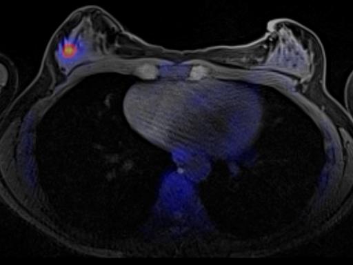 Biograph mMR - Siemens Healthineers France