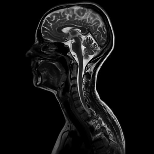 Tim - Siemens Healthineers USA