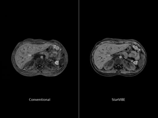 Growth with Body MRI - Siemens Healthineers USA