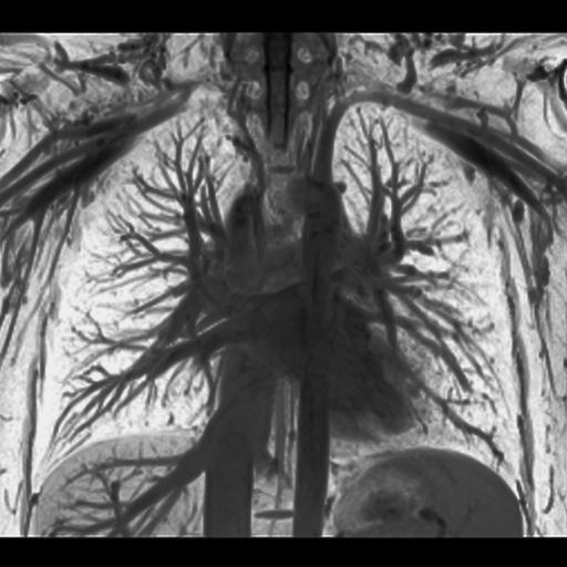 Tim - Siemens Healthineers USA