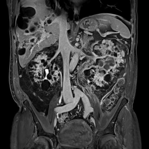 Tim - Siemens Healthineers USA