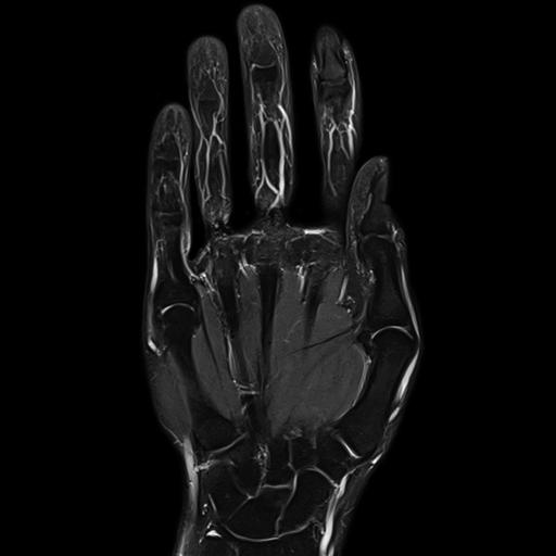 Tim Technology - Siemens Healthineers