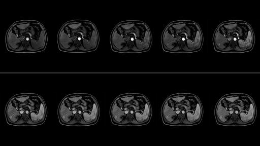 FREEZEit - Siemens Healthineers USA