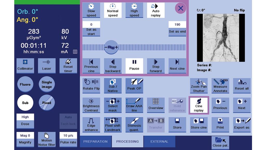 Cios Alpha - Siemens Healthineers Japan