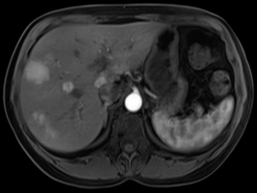 RM Corporal - Siemens Healthineers Brasil