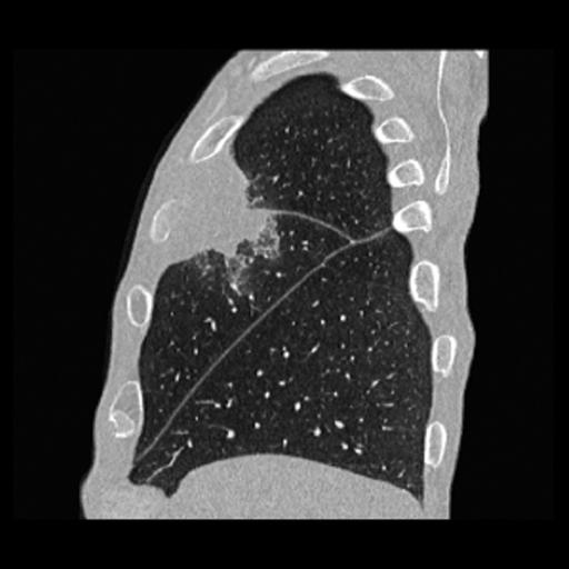 CT Scanner SOMATOM Scope - Siemens Healthineers USA