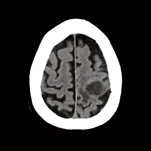 CT Scanner SOMATOM Scope - Siemens Healthineers USA