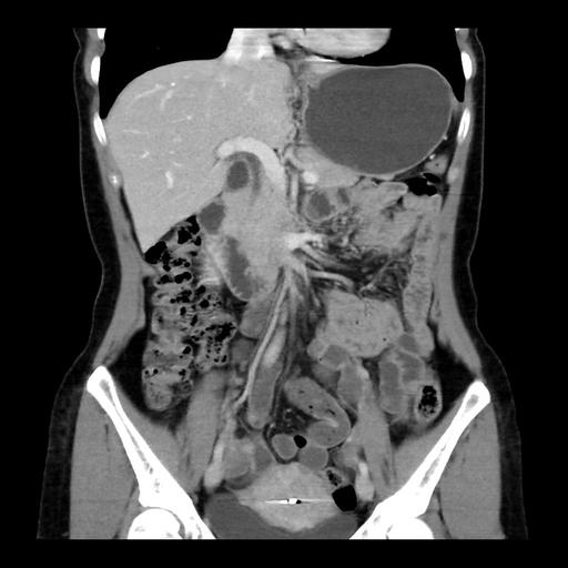 CT Scanner SOMATOM Scope - Siemens Healthineers USA