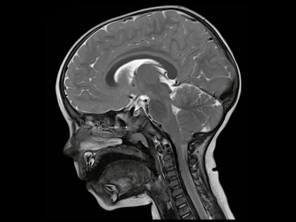 Pediatric MRI - Siemens Healthineers