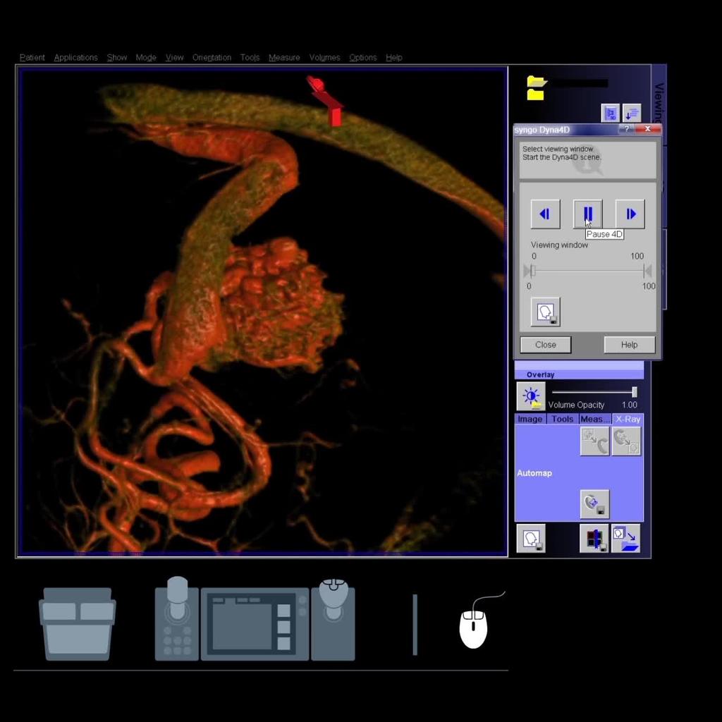 Options & Upgrades - Get the most from your investment - Siemens ...