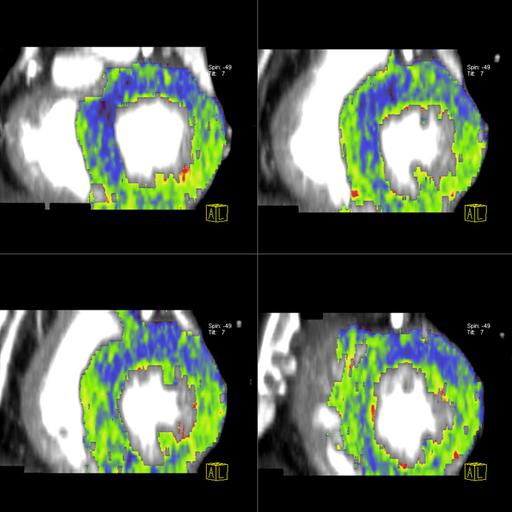SOMATOM Definition Flash - CT Scanner - Siemens Healthineers Vietnam