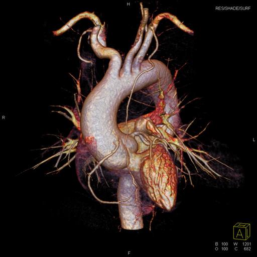 SOMATOM Definition Flash - CT Scanner - Siemens Healthineers Vietnam