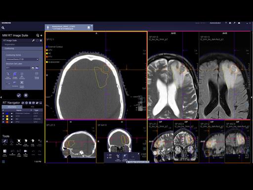 syngo.via RT Image Suite - Siemens Healthineers Brasil