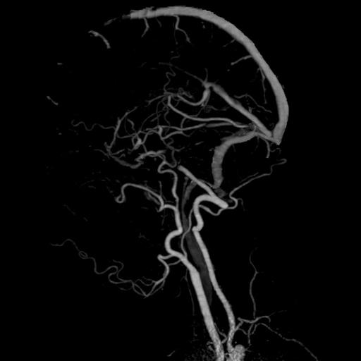 CT Scanner SOMATOM Scope - Siemens Healthineers España