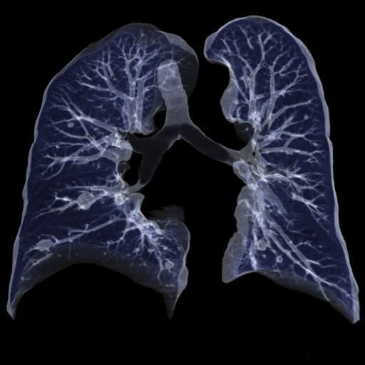 CT Scanner SOMATOM Scope - Siemens Healthineers España