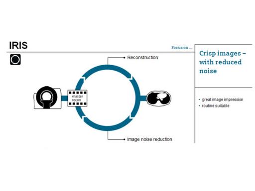 CT Scanner SOMATOM Scope - Siemens Healthineers USA