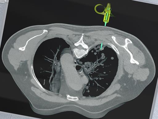 Computed Tomography - Siemens Healthineers USA