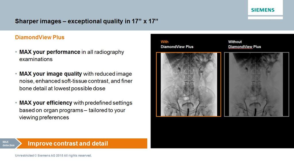 Approaches to Dose Reduction in Urology - Siemens Healthineers USA