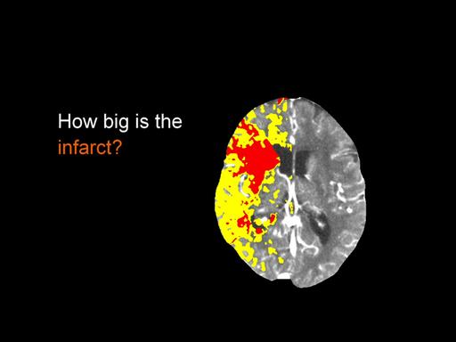 CT Neuro Engine - Siemens Healthineers USA
