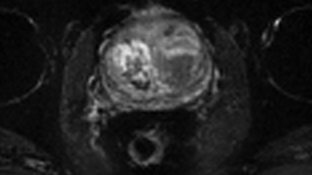 Prostate MRI - Siemens Healthineers USA