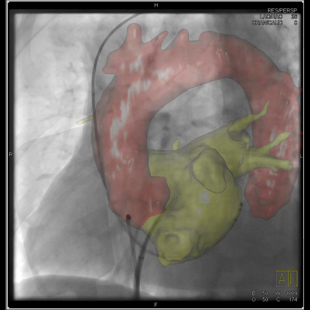 syngo DynaCT Cardiac - Siemens Healthineers USA