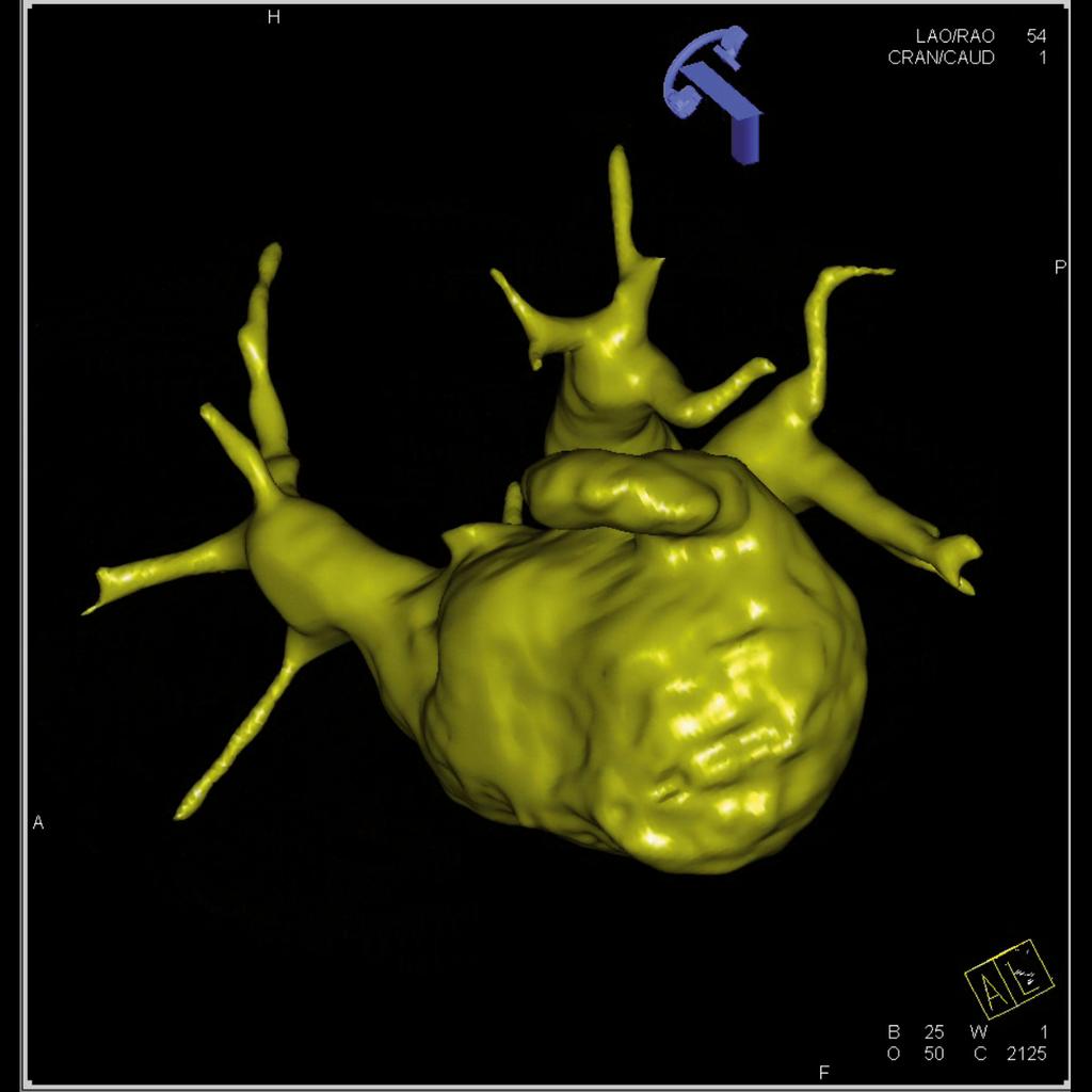 syngo DynaCT Cardiac - Siemens Healthineers USA