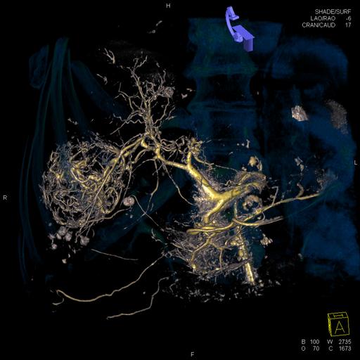 syngo DynaCT - Siemens Healthineers