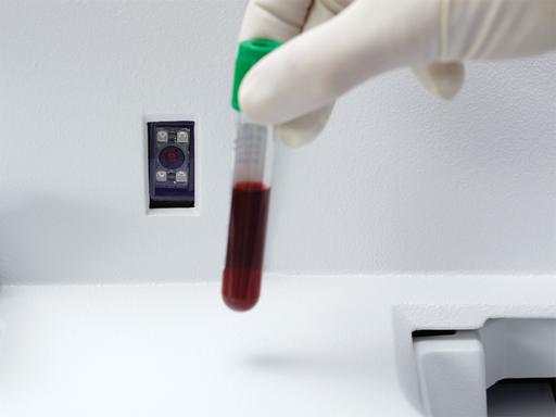 Stratus CS 200 Acute Cardiac Care Troponin Analyzer